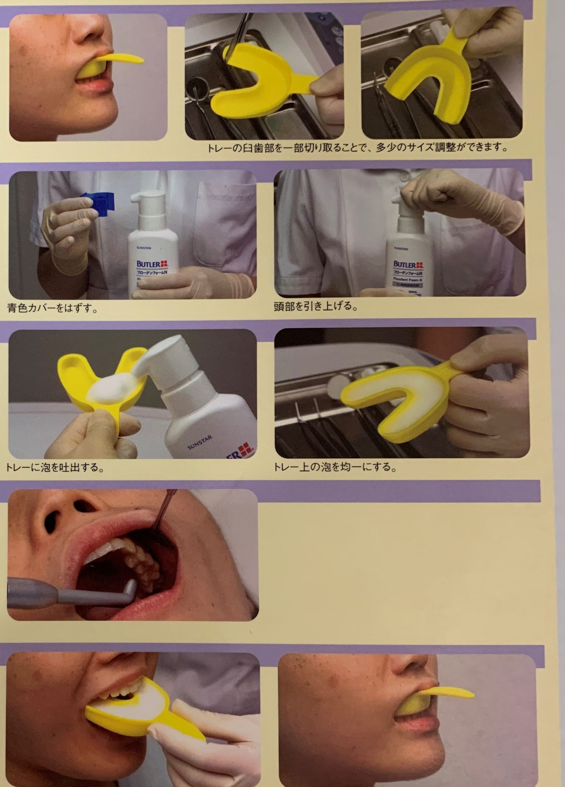 フッ素塗布はちょいちょいと塗るだけではありません。 - 京都府宇治市の歯医者「なかむら歯科医院」新田駅、大久保駅近く、駐車場完備